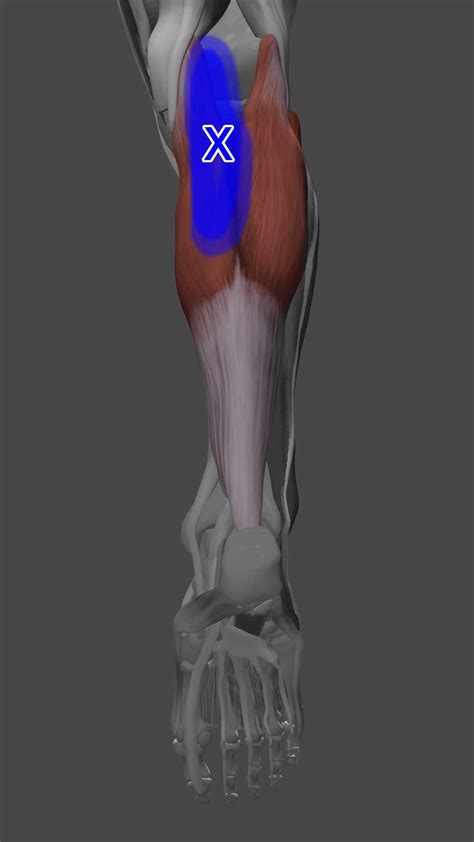 Acupuncture For Calf Trigger Points Morningside Acupuncture NYC