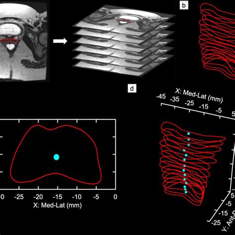 Calculation Of The Central Vaginal Axis A D Segmentation Dotted Download Scientific