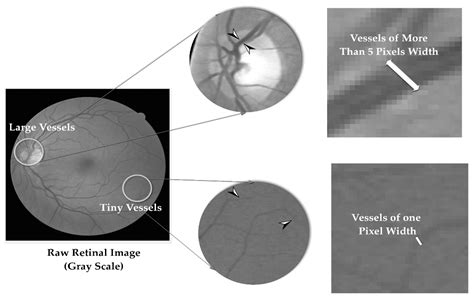 Retinal Vessels Segmentation Techniques And Algorithms A Survey