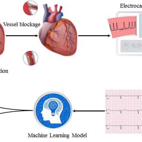 Schema Diagram For Machine Learning Based Mi Detection Download