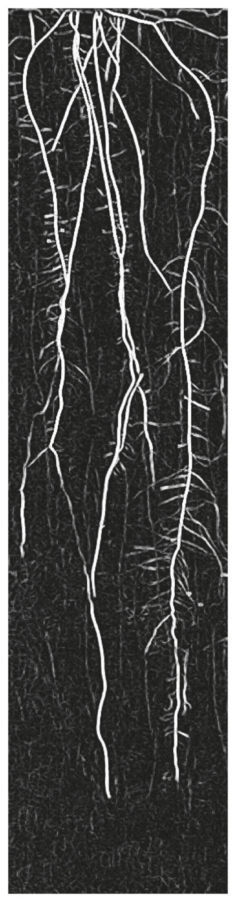 The Comparison Of Original Frangi Filtering A C And Frangi With