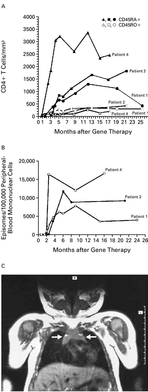 Numbers Of Naive Cd45ra And Memory Cd45ro T Cells Panel A And