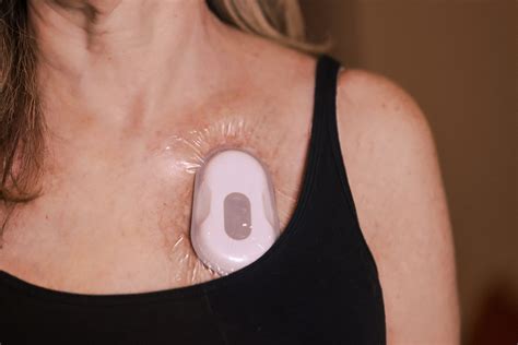 Wheeze Monitor And Asthma Wearable Device Resp® Biosensor