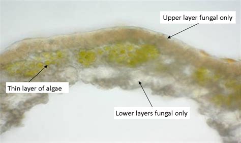 Lichen Cross Section