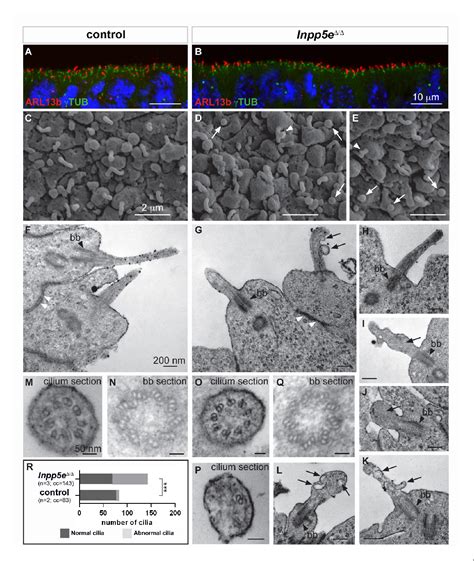 Figure 6 From A Transient Role Of The Ciliary Gene Inpp5e In Controlling Direct Versus Indirect
