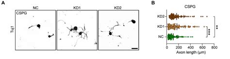 Figure Supplement 1 Alkbh5 Knockdown Promotes Drg Neurite Outgrowth In
