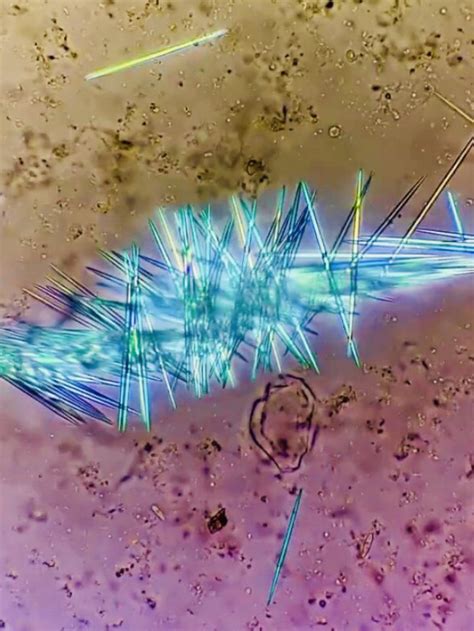 Pineapple Under Microscope Biology Notes Online