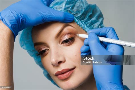 의료 진료소에서 얼굴의 눈 영역을 수정하기 위한 성형 수술 수술 전에 얼굴에 Blepharoplasty 마크업 클로즈업 2 의사가 플라스틱 화장품 작업을 수행 안검 성형술에