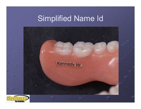 Denture Ids