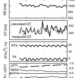 QT Interval Dynamics In A Healthy Middleaged Person See Text For Download Scientific Diagram
