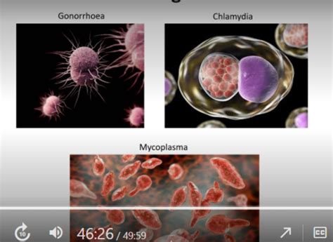Pid Flashcards Quizlet