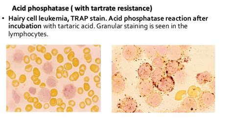 Lecture Notes In Medical Technology Lecture 14 Blood Cell Cytochemistry