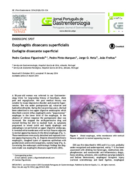Pdf Esophagitis Dissecans Superficialis