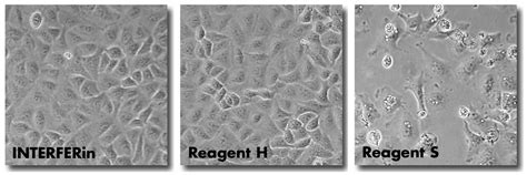 Biolink Laboratoriesinterferin® Sirna Transfection Reagent Biolink