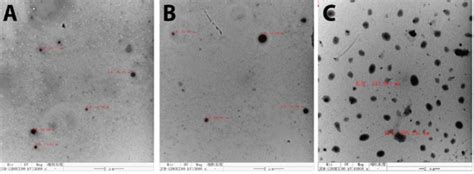 Characterization Of Tem Of The Optimized Bare Nlcs Displaying A Download Scientific Diagram