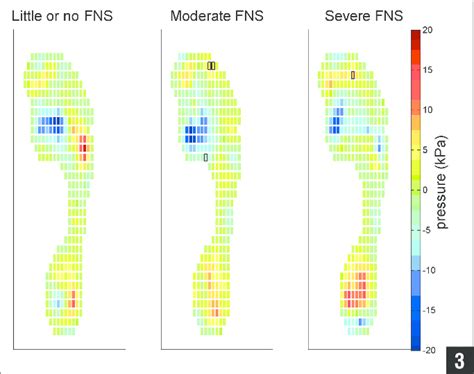 Differences In Plantar Pressure Distribution Between The Fractured And