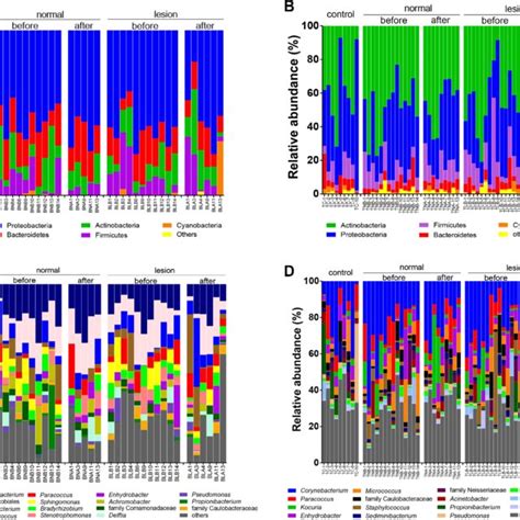 Bar Chart Showing Relative Abundance Of Skin Microbiota Of Patients