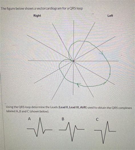 Solved The Figure Below Shows A Vectorcardiogram For A Qrs