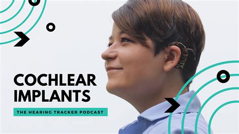 Cochlear Implants Surgery Activation And Life With Cis