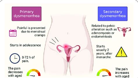 Main Differences Between Primary And Secondary Dysmenorrhea Download