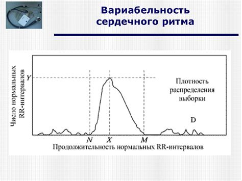 Холтеровское мониторирование ЭКГ - современные аспекты применения ...