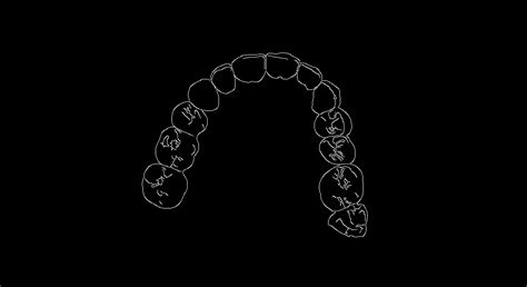 python return position and size of arbitrary teeth shapes in image using opencv stack overflow