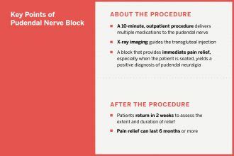 Nerve Block Relieves Chronic Vaginal Pain NYU Langone Health Physician Focus