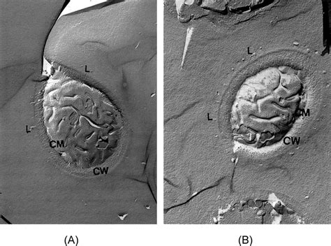 Candida Glabrata Was Mixed With Non Drug Containing Liposomes With The