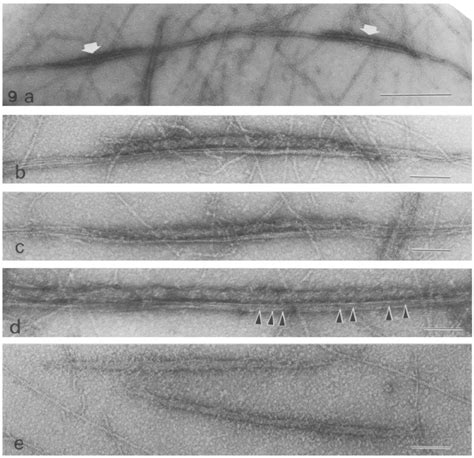 Electron Microscopy Of Actomyosin During The Active Movement A Download Scientific Diagram