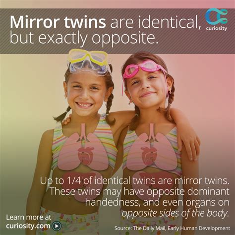 Identical Twins Mirror Organs At Tina Lown Blog