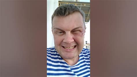 Сказ о том как дела у меня лично в госпитале и какие радостные перспективы Как я это всё