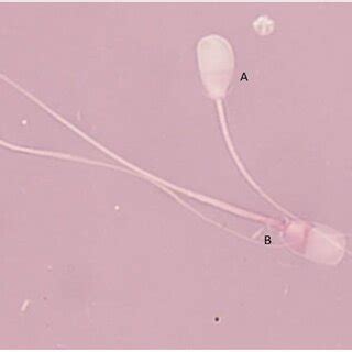 Sperm Head Morphometry Measurements Download Scientific Diagram