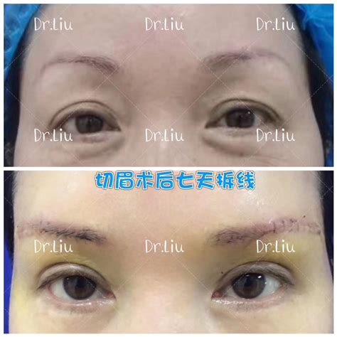 切眉和提眉哪个效果好 提眉和切眉的区别 大山谷图库
