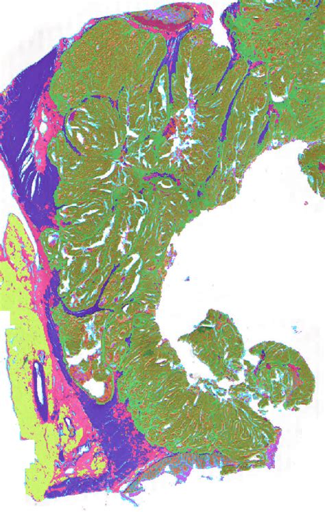 Colon Tissue Segmentation Grand Challenge