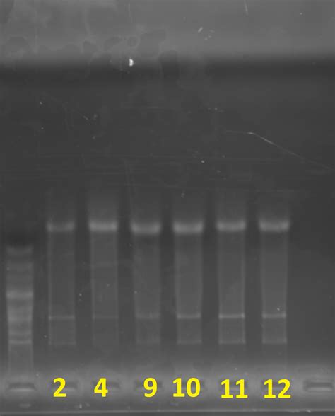 Rna Gel Loading Dye Recipe Bryont Blog