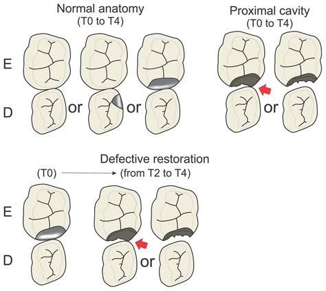 Tooth Surface Anatomy