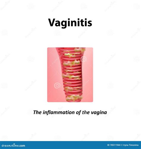 Vagina Cartoons Illustrations Vector Stock Images Pictures To Download From
