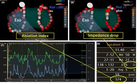 Representative Figure For Relevant Parameters In An Acute PVR Site On Download Scientific