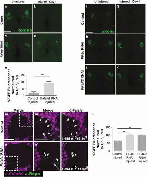 The Pp4 Complex Subunits Falafel Pp4c And Pp4r2 Are Required For