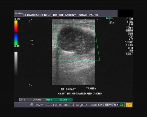 A Gallery Of High Resolution Ultrasound Color Doppler And 3d Images