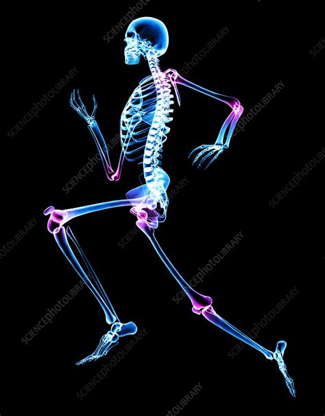 Arthritis Joints Stock Image M110 0661 Science Photo Library