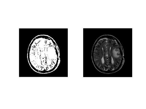 Masks And Region Of Interests Rois · Matlab For Mri Applications