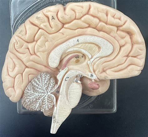 Midsagittal Section Of The Brain Diagram Quizlet