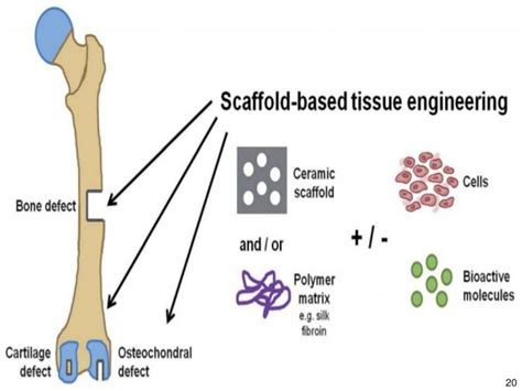 Potensi Terapi Sel Punca Stem Cell Untuk Kasus Bone Defect