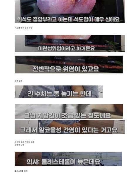 하루에 소주 3병씩 마시는 유튜버 근황  유머 움짤 이슈 에펨코리아