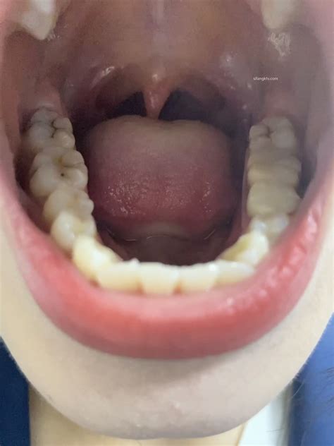 Chinese Glasses Girl Uvula 10 ThisVid Com Chinese Glasses Girl Uvula 10 ThisVid Com