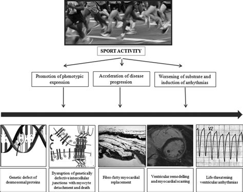 Arrhythmogenic Cardiomyopathy Circulation Research