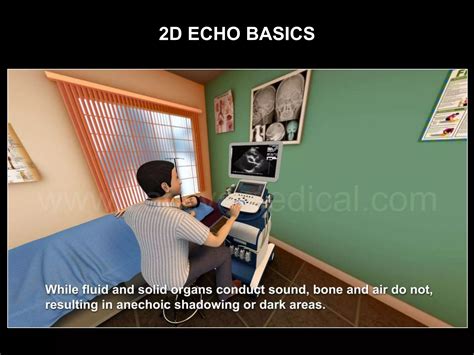 2d Echo Basics Pptx