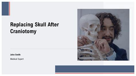 Replacing Skull After Craniotomy PPT Guidelines ACP PPT Template
