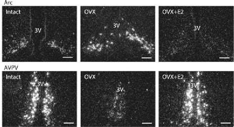 Anteroventral Periventricular Nucleus Semantic Scholar